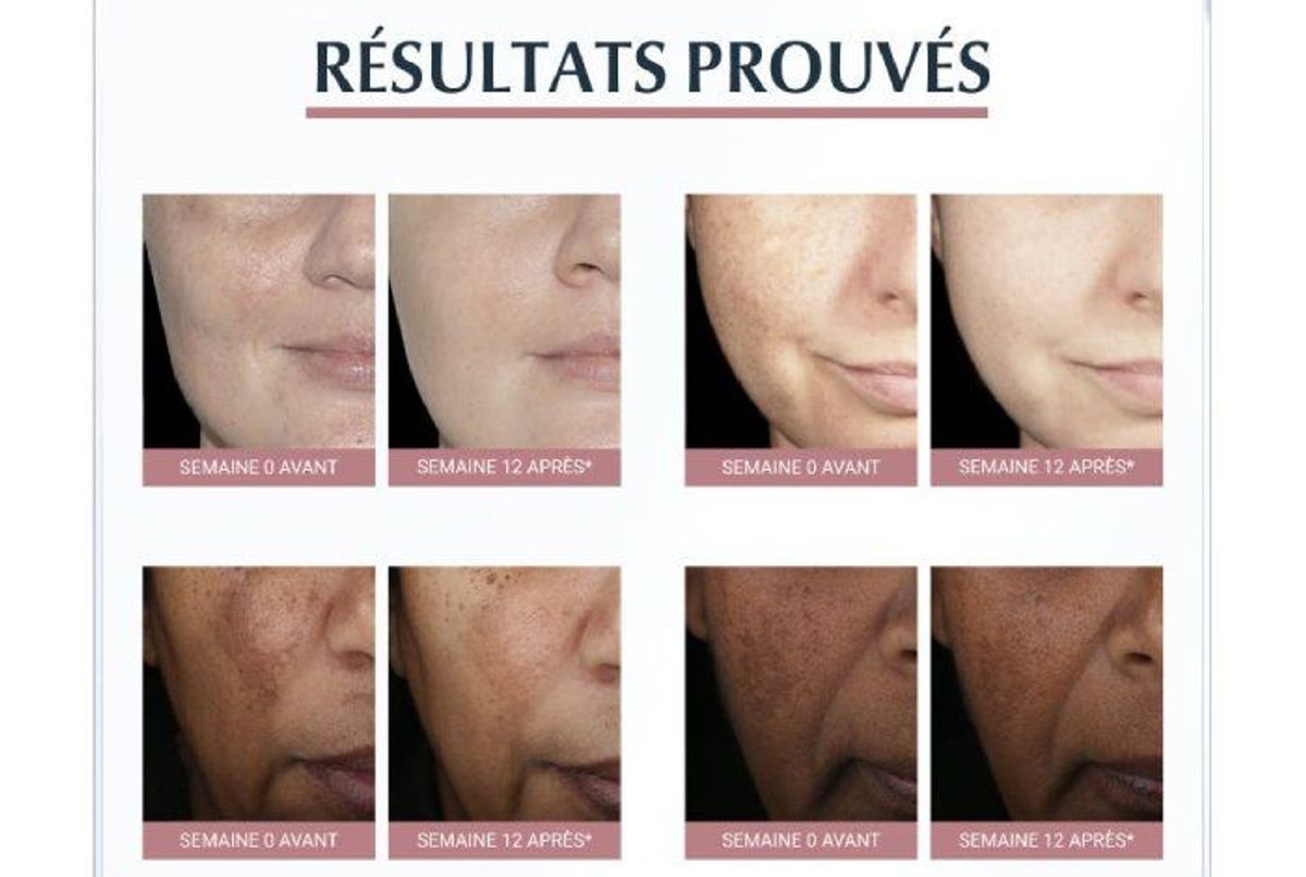 Taches brunes : ce soin correcteur unifie la peau et prévient leur ...