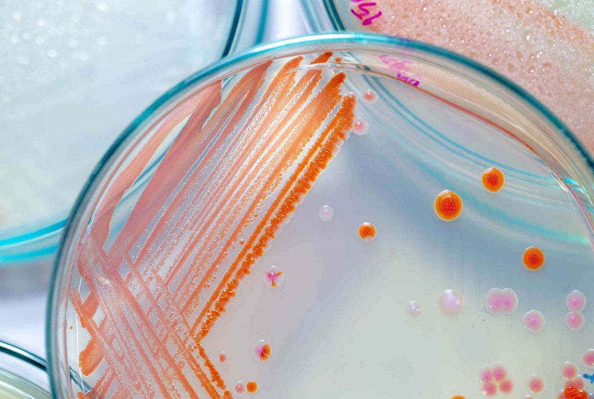 Cas de botulisme en France : 9 questions sur cette maladie rare mais ...